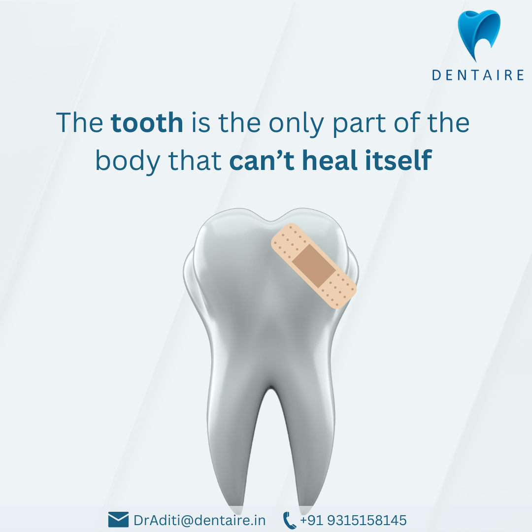 Painless Root Canal Treatment in Gurgaon | Best Gurgaon Dentists